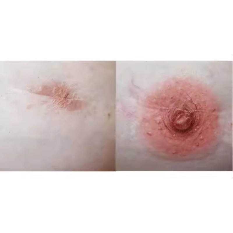 Areola Reconstruction Tattoos in Maine: Restoring Confidence